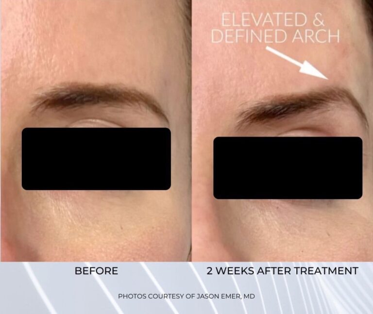 Gallery | Cure Med Spa