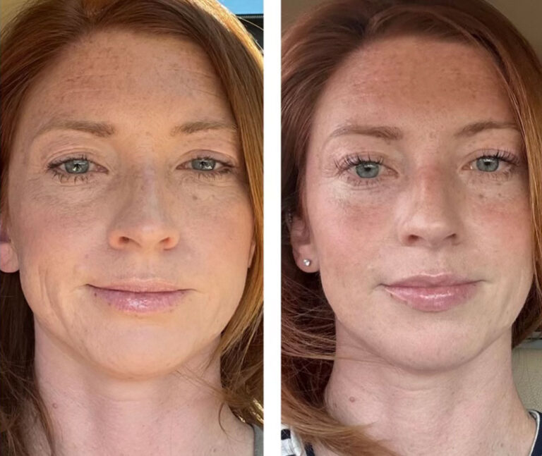 Gallery | Cure Med Spa